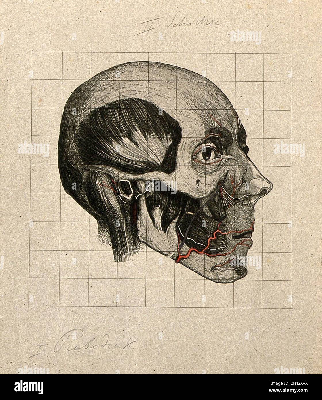 Écorché head of a man, shown at layer beneath superficial muscles, seen ...