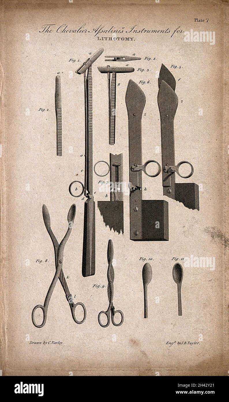 Surgical instruments: instruments for lithotomy designed by Paolo ...
