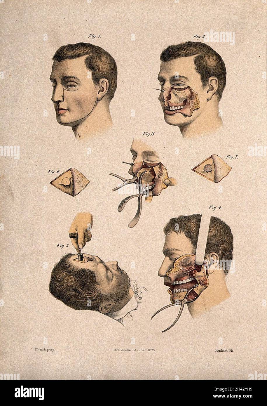 Cross-sections through the human face and jaw. Coloured lithograph by M ...