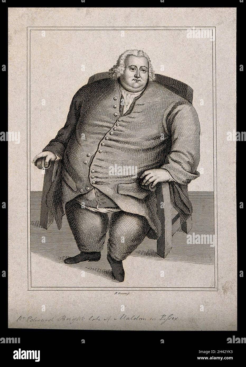 Edward Bright, a man weighing forty three and a half stone. Line ...