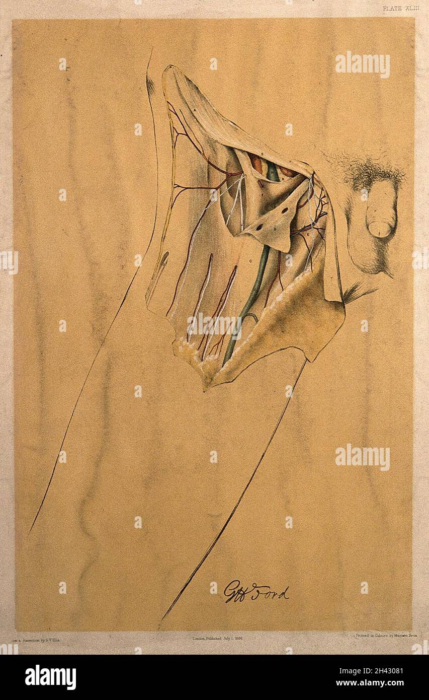 Dissection of the groin and upper thigh of a man, showing the blood ...