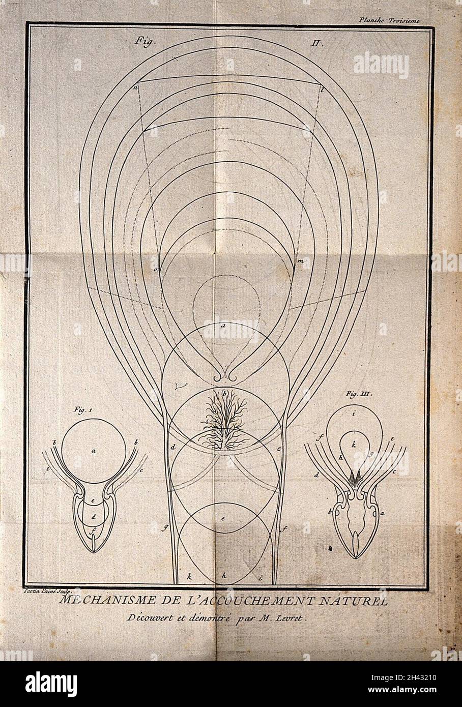 Three interior diagrams of an adult human uterus. Etching by G. Scotin ...
