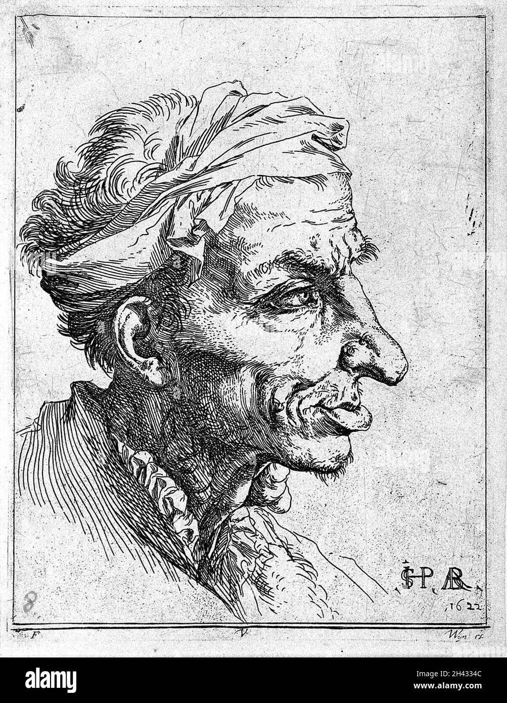 The head of a man with goitre. Etching by Jusepe de Ribera, 1622 Stock ...