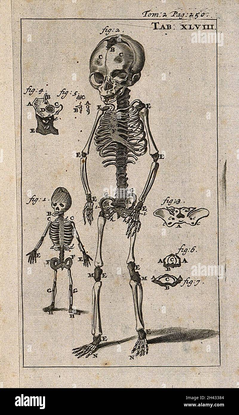 The skeletons of two foetuses, two and five months old, demonstrating ...