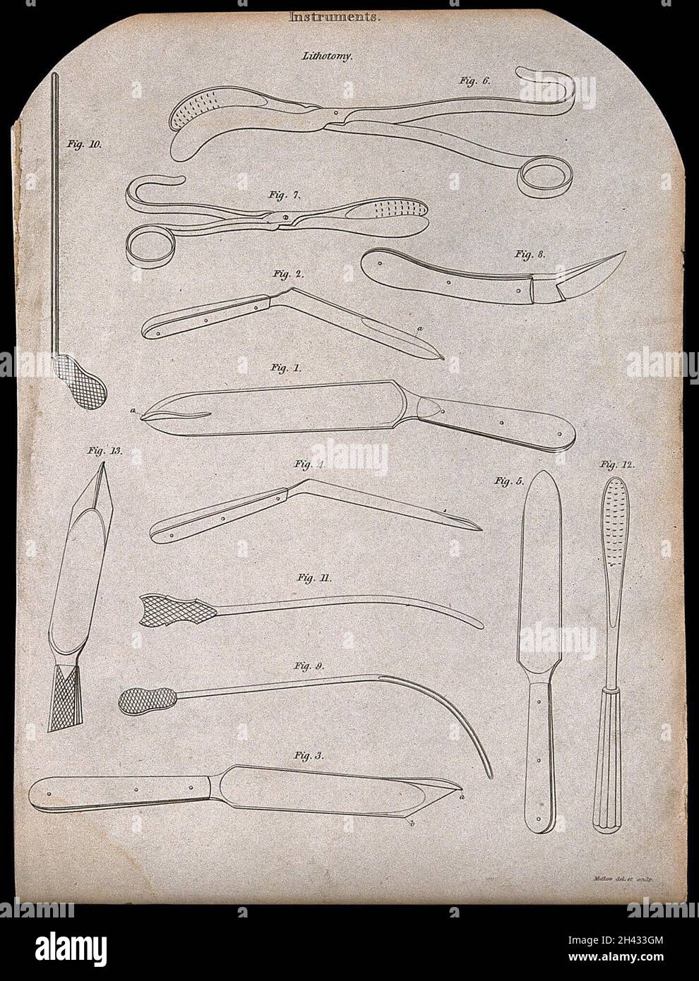 Lithotomy history hi-res stock photography and images - Alamy