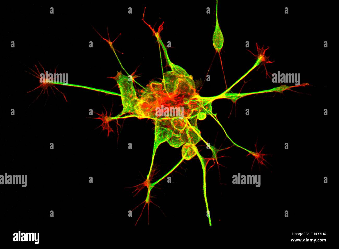 Dorsal Root Ganglion neurones in culture Stock Photo - Alamy