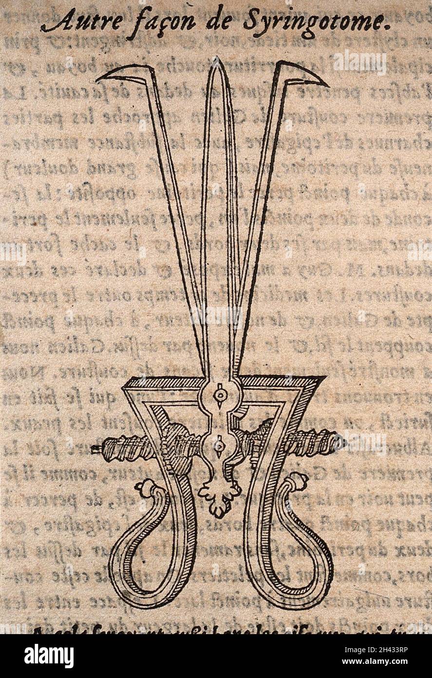 16th century medical instruments hi-res stock photography and images ...