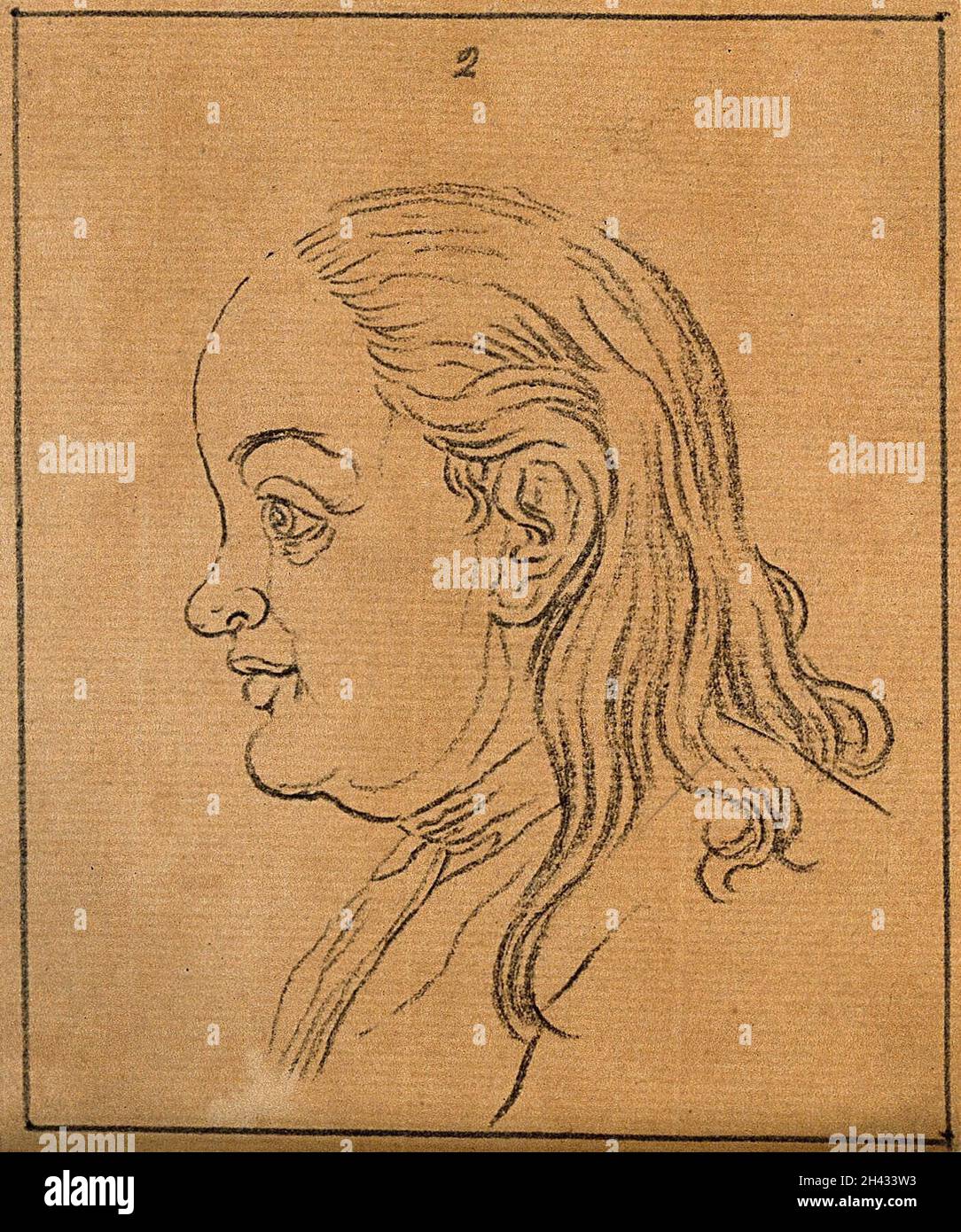 Phlegmatic temperament hi-res stock photography and images - Alamy