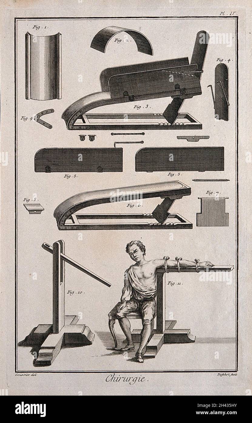 Surgical fractures hi-res stock photography and images - Alamy