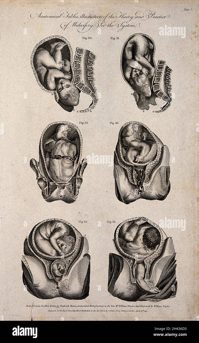 Baby positions in womb hi-res stock photography and images - Alamy