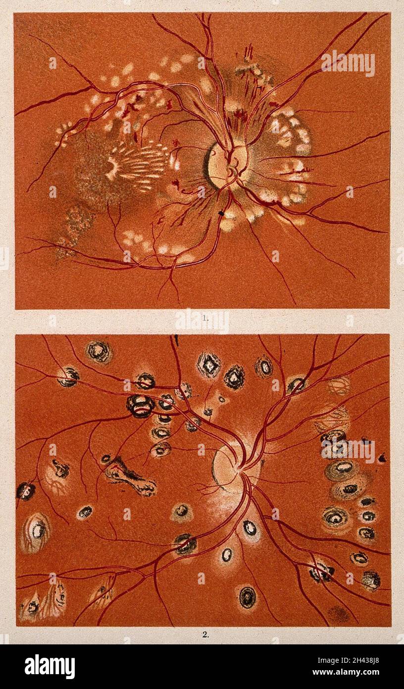 The eye, as seen through a microscope: two figures. Colour lithograph ...