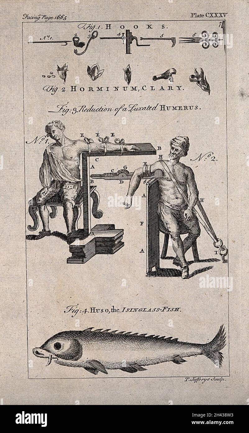 Above, surgical instruments and apparatus to cure a fractured humerus ...
