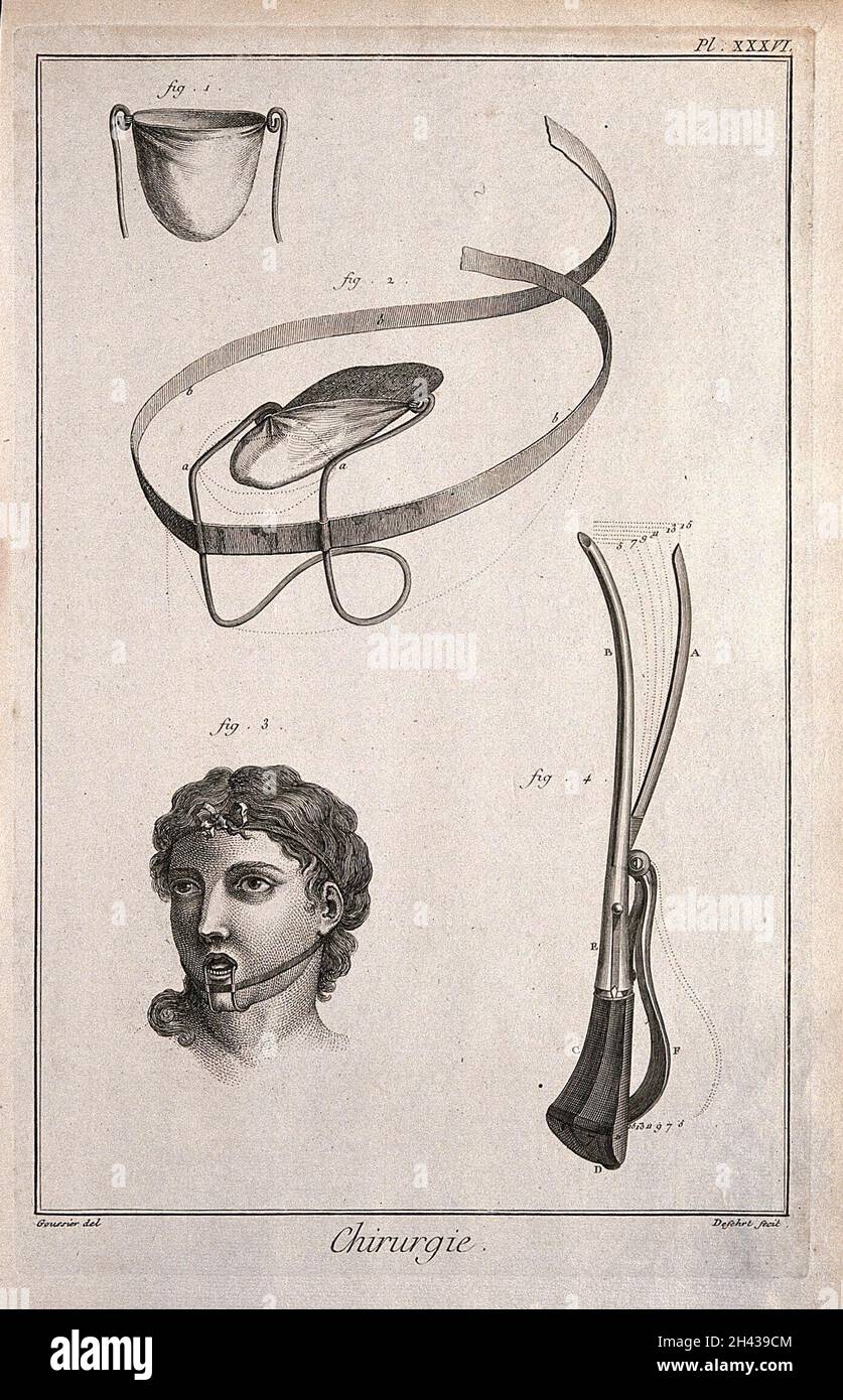 Surgery: surgical instruments, including a bandage for the tongue ...