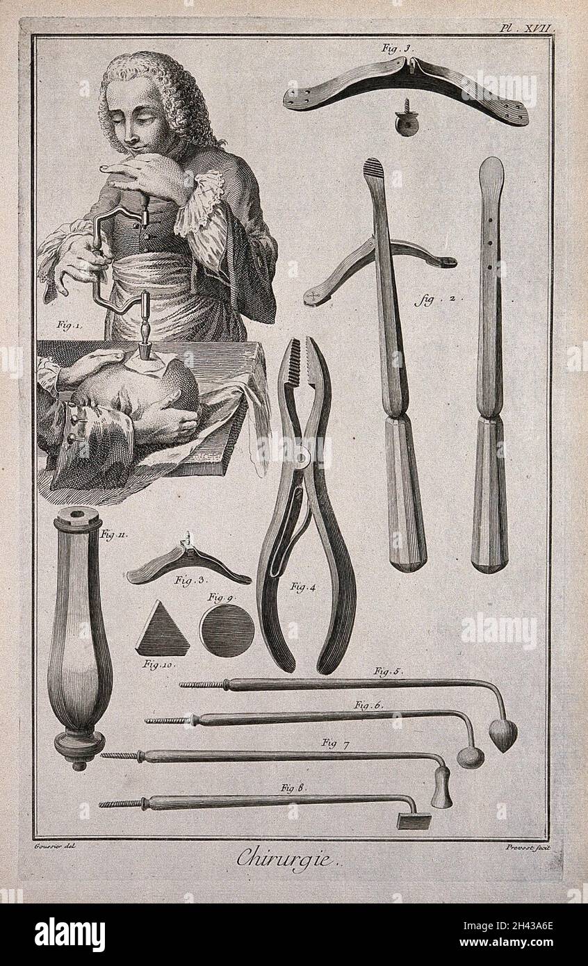 Surgery: above, a skull being trepanned; below, various instruments ...