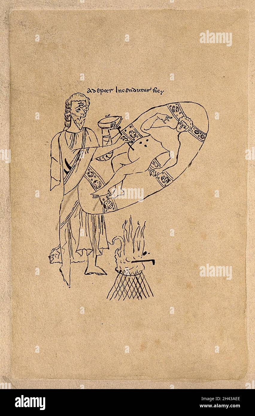 A surgeon applying a cautery iron to clearly defined points on a woman ...