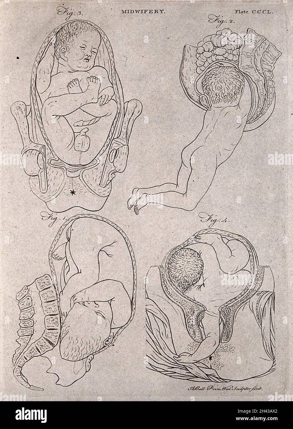 Four diagrams illustrating difficult births. Engraving by A. Bell Stock ...