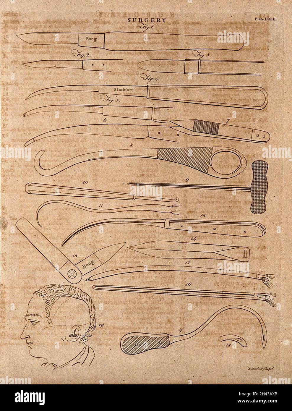 Surgical instruments, mainly needles and knives. Engraving by E ...