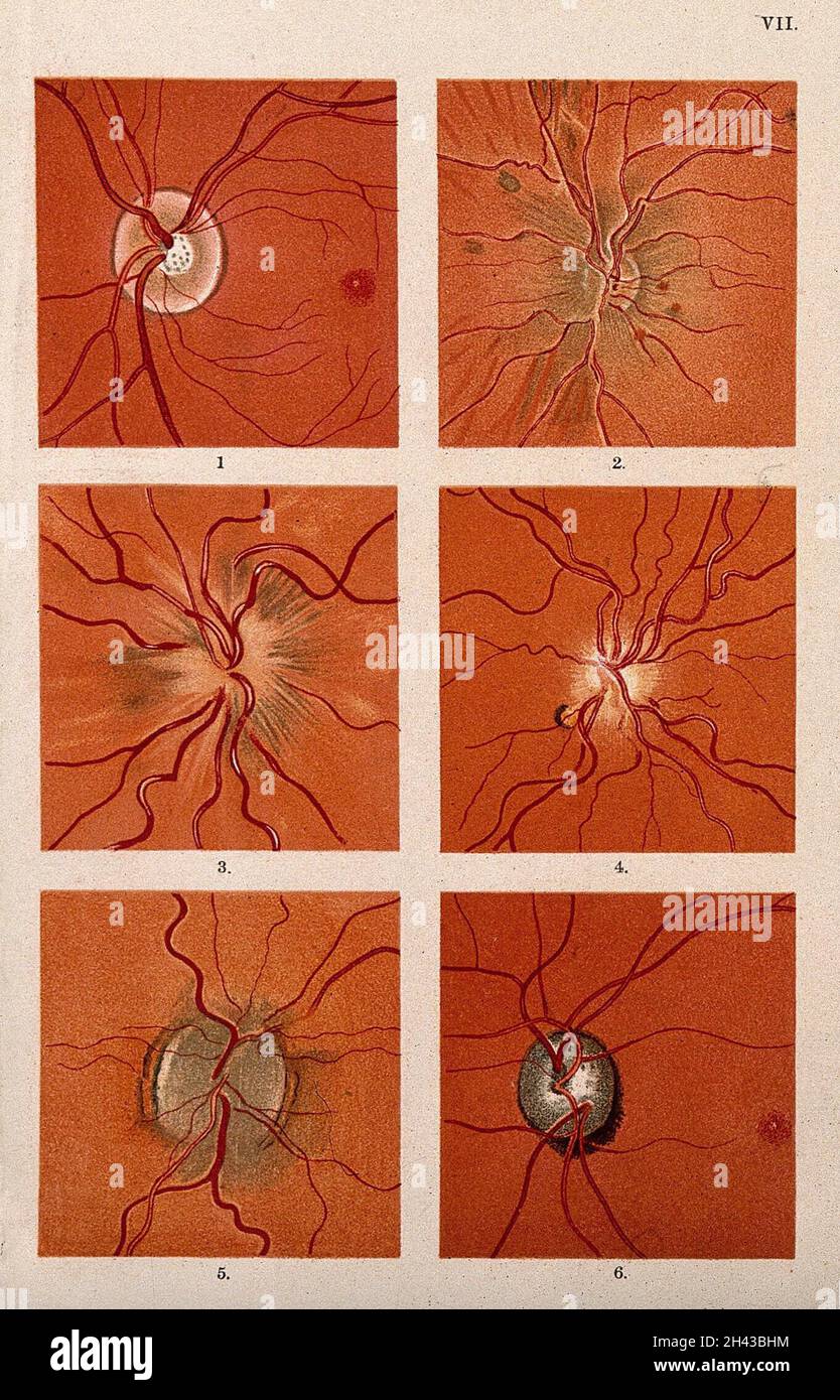 The eye, as seen through a microscope: three figures. Colour lithograph ...