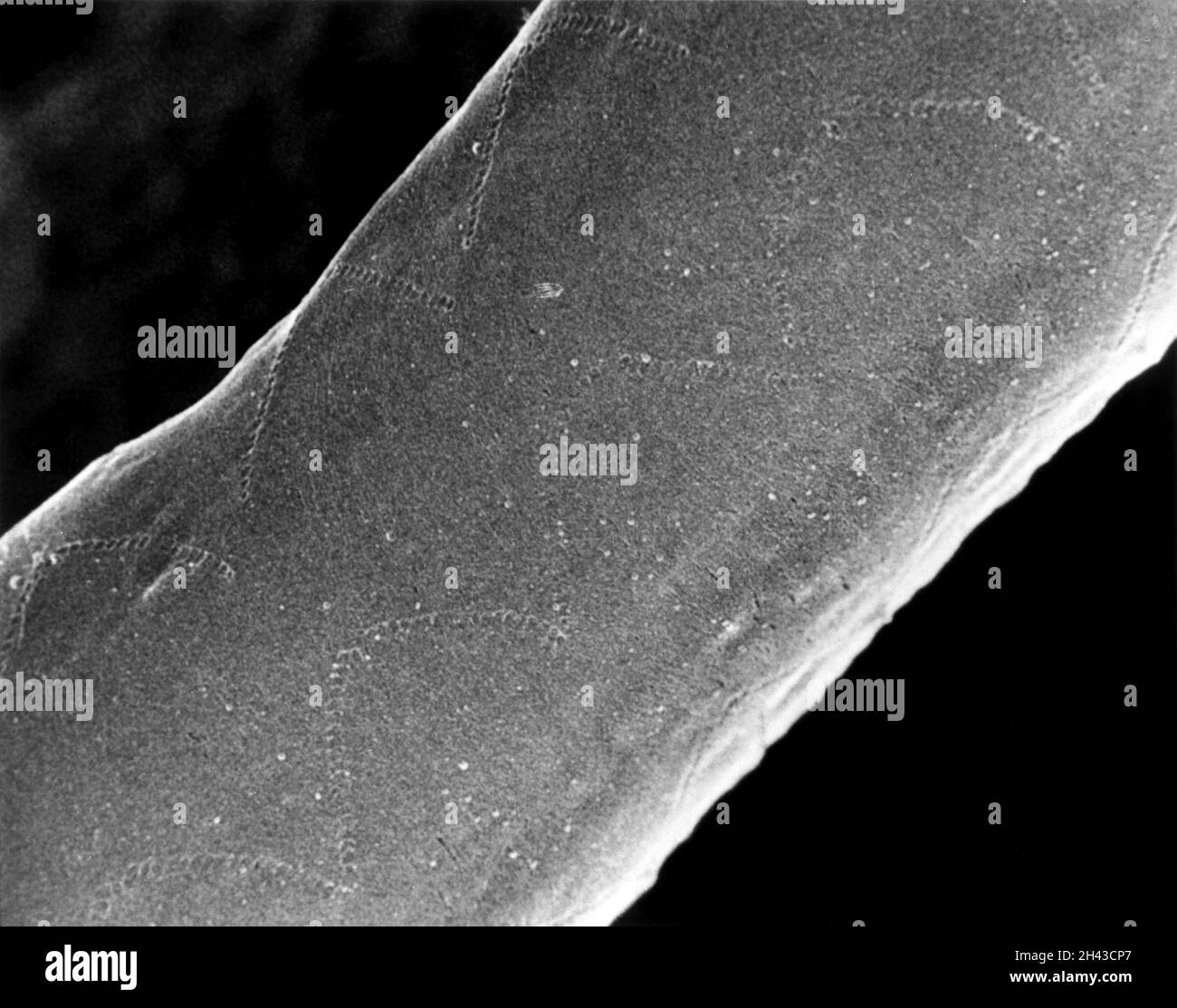 Tectorial membrane from cochlea, SEM Stock Photo - Alamy