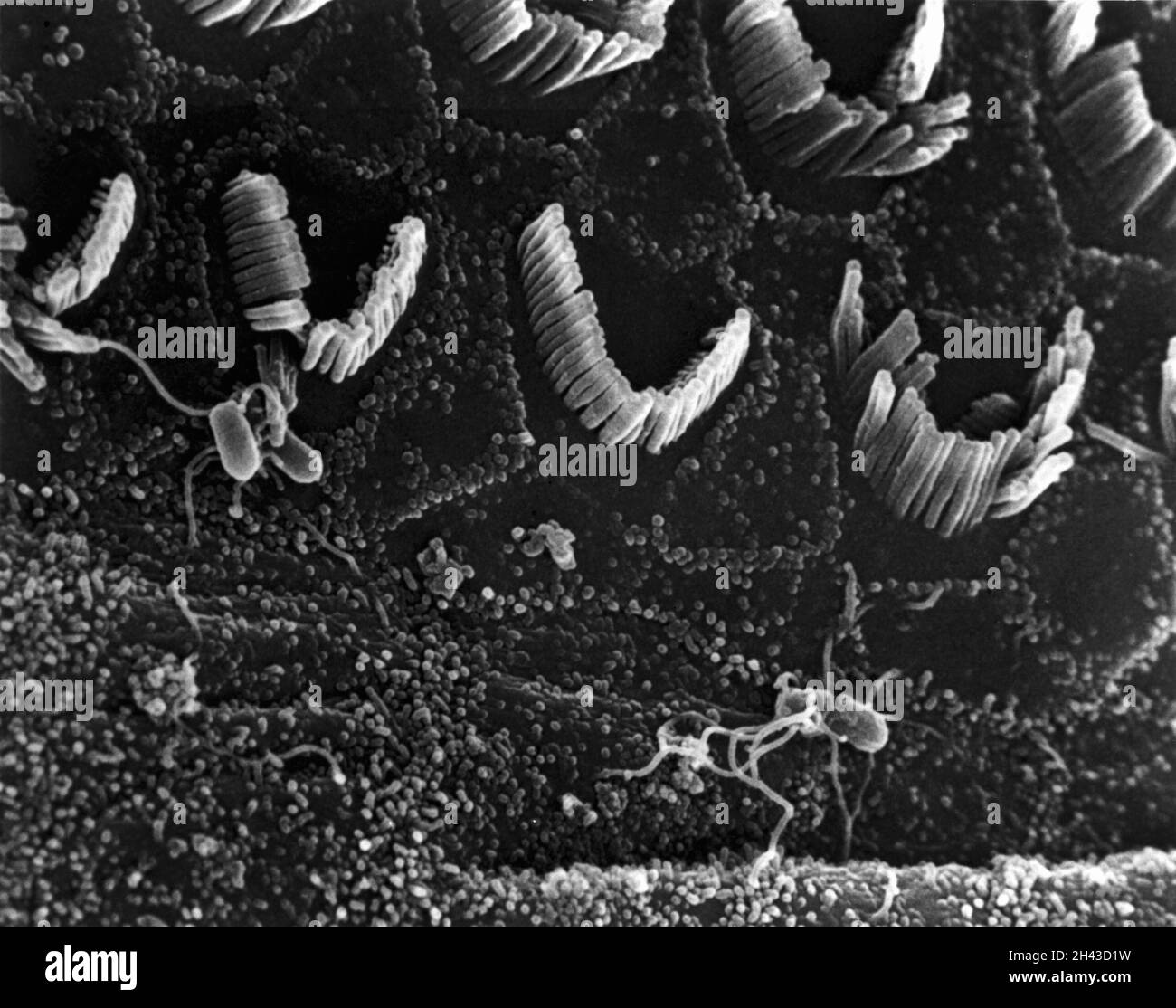 Microscopic view cochlea inner ear hi-res stock photography and images ...