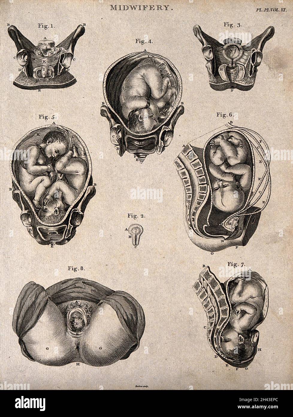 Eight diagrams illustrating babies in the womb and internal structures ...