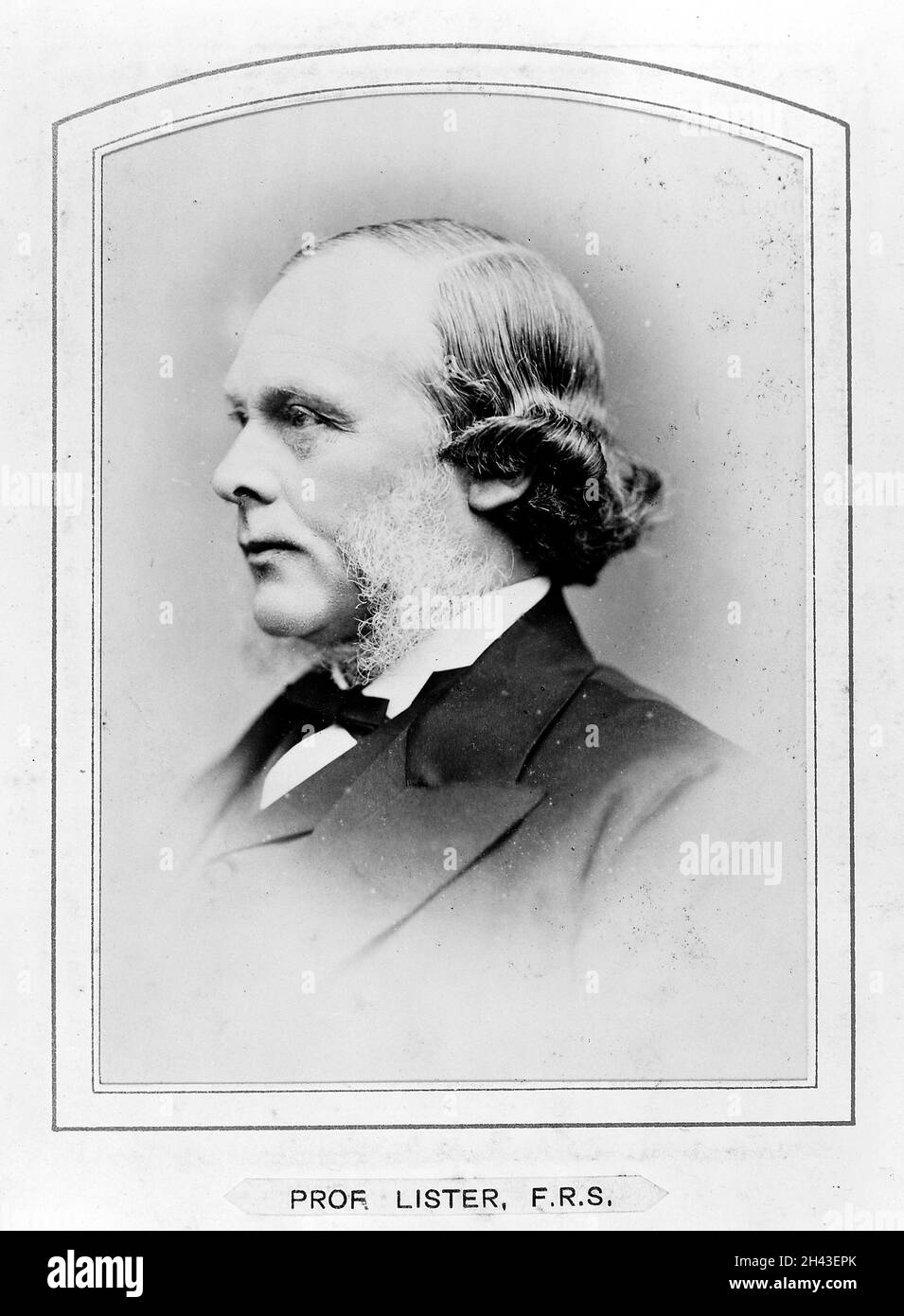 Joseph Lister, Baron Lister. Photograph by Barraud Stock Photo - Alamy
