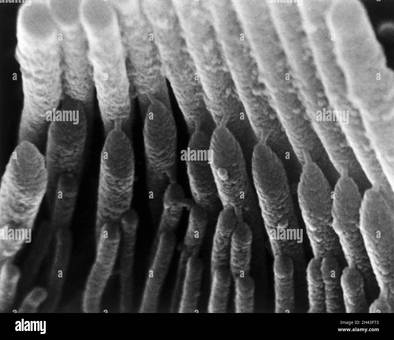 Human Hair Cells Under A Microscope