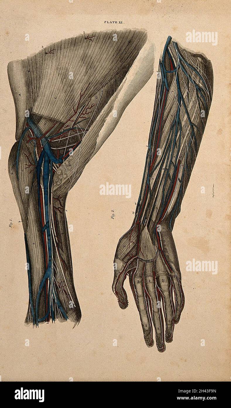 Arm and shoulder: two figures of a dissection, with blood vessels and ...