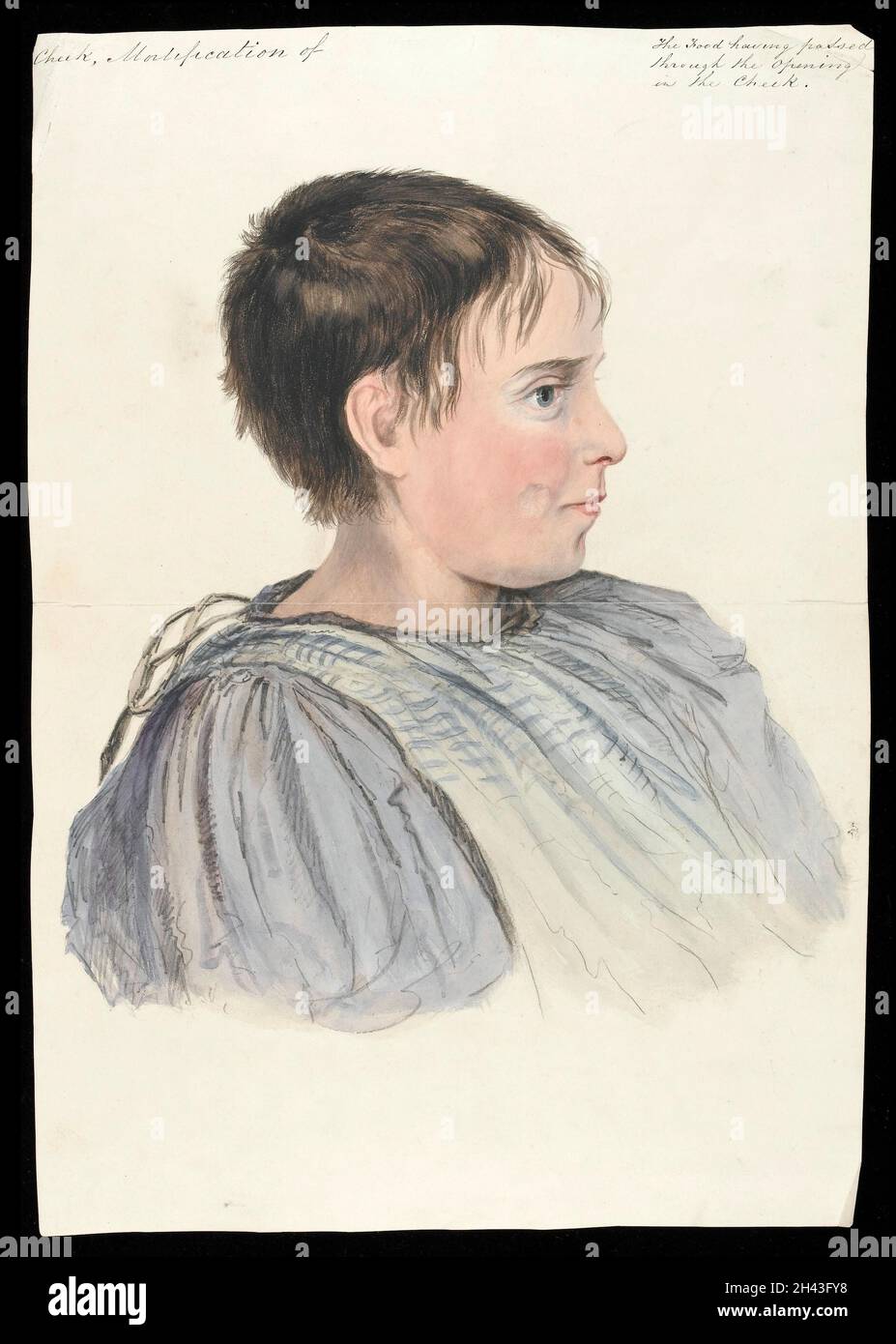 Right cheek hi-res stock photography and images - Alamy