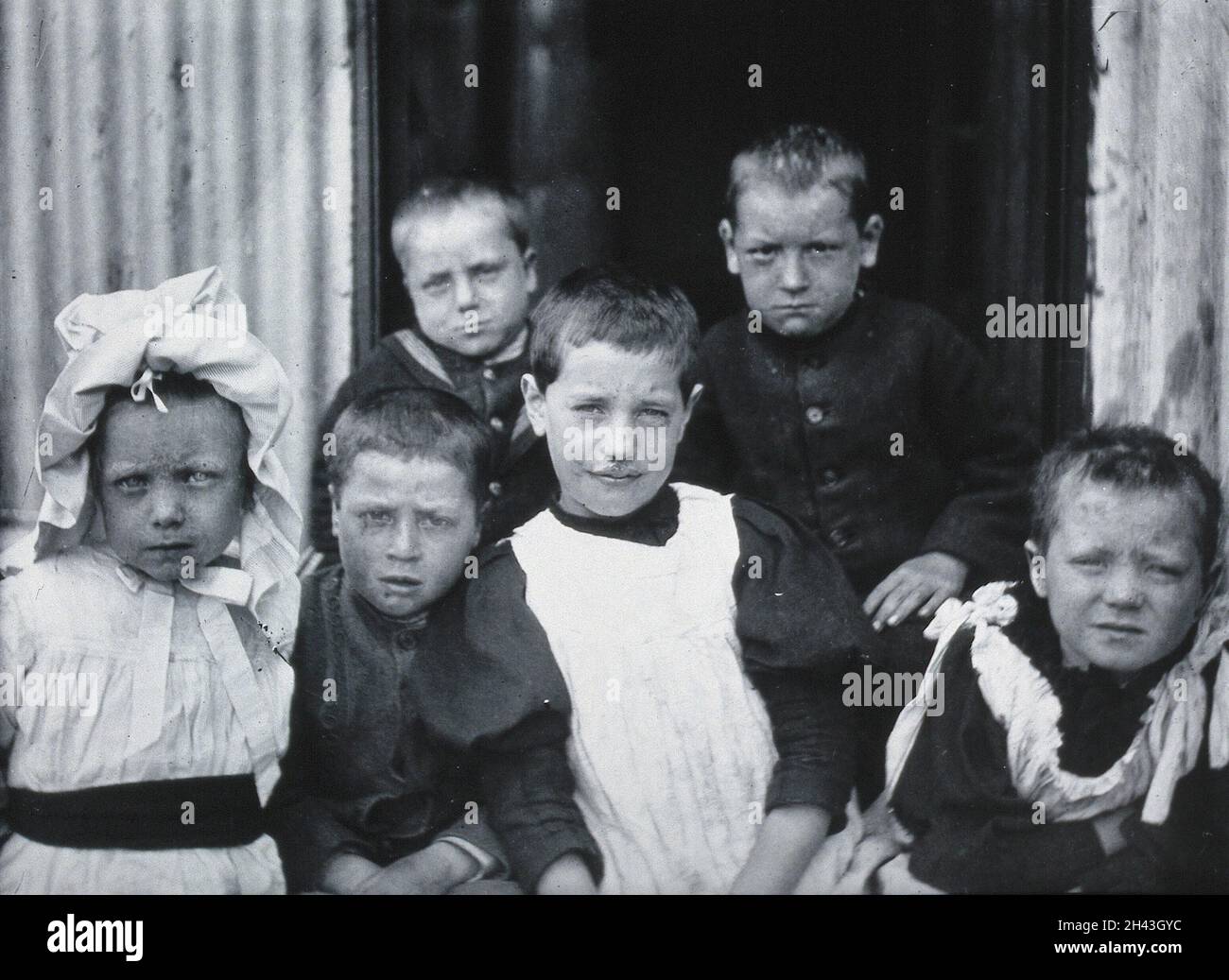 Smallpox epidemic hi-res stock photography and images - Alamy