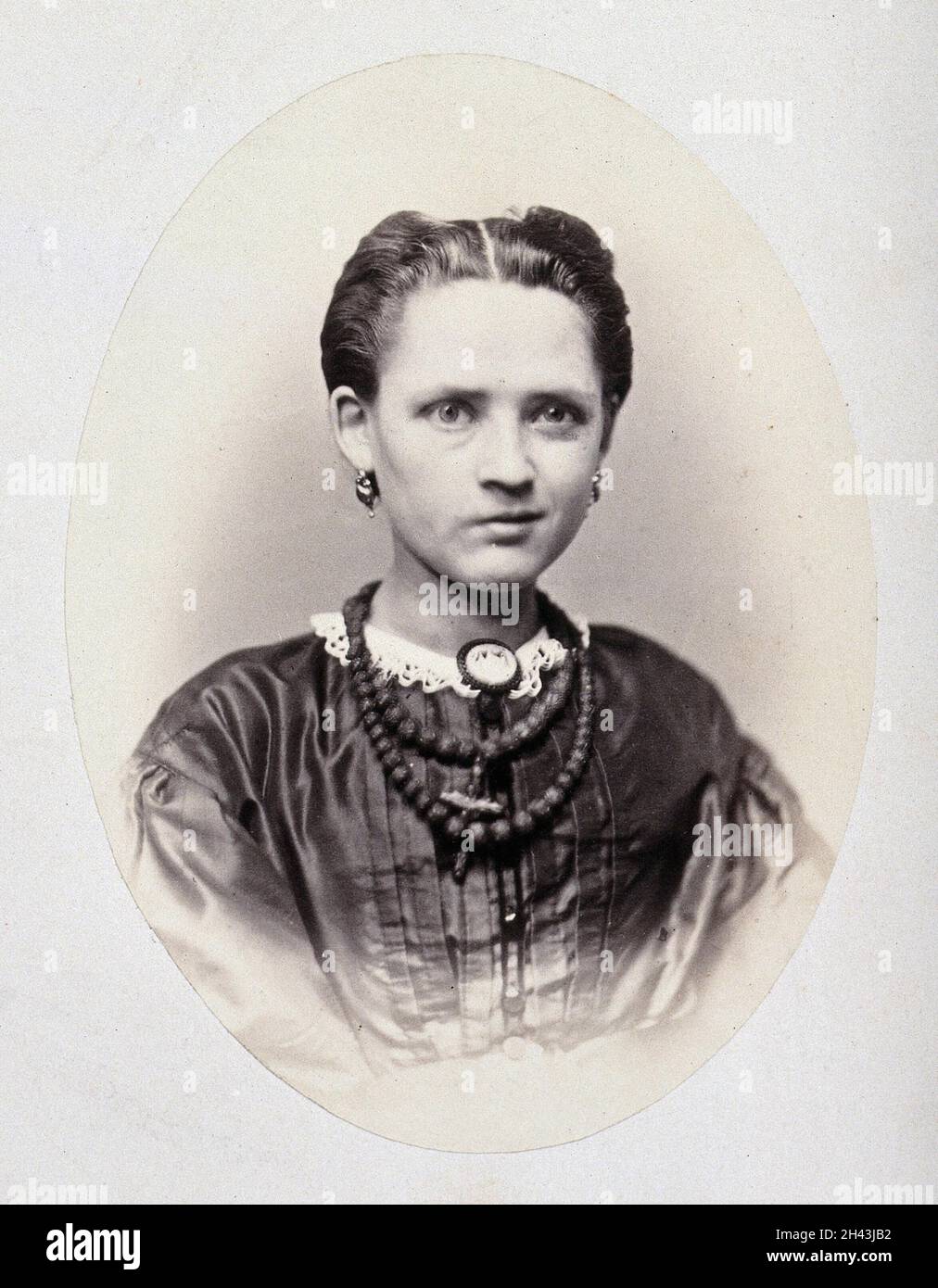 A young woman, head and shoulders; her face is slightly contorted ...