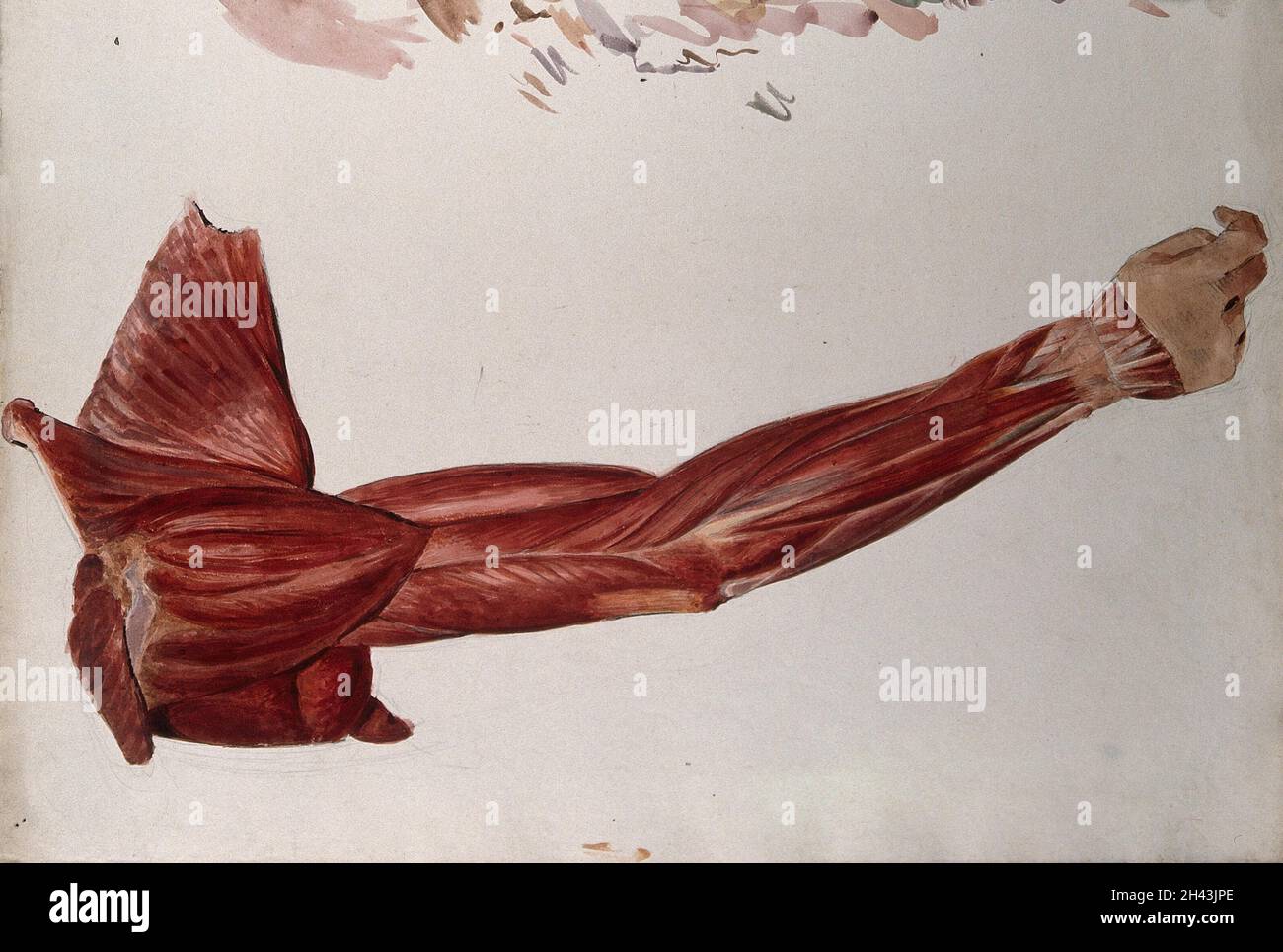 Dissection showing the muscles of the arm and shoulder, back view ...