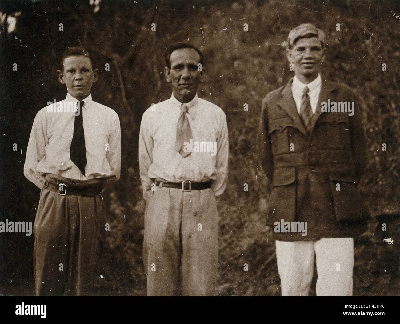 Leprosy sufferers, India: three Anglo-Indian men. Photograph, 1900/1920 ...