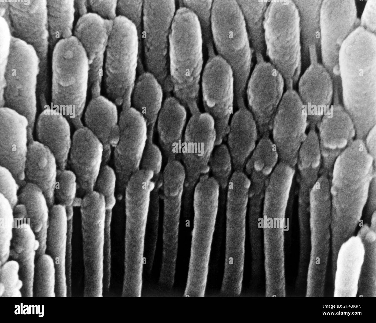 Stereocilia from human cochlea, SEM HP Stock Photo - Alamy