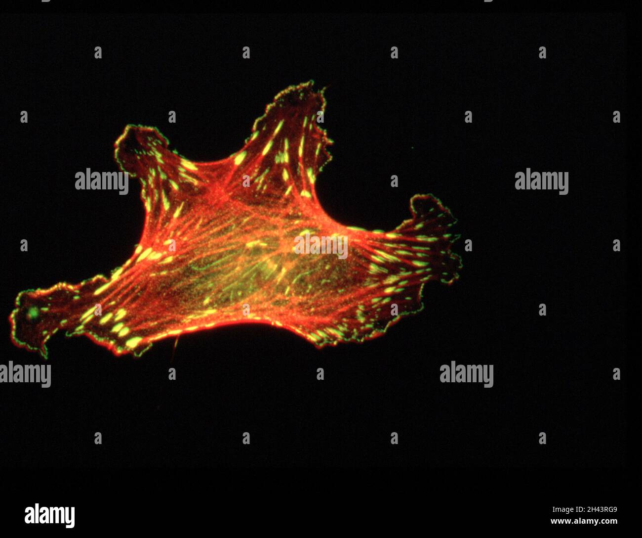 Stress fibres, focal adhesions & lamellae Stock Photo - Alamy