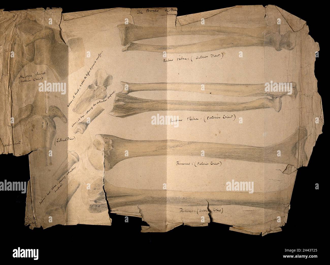 Bones of the arm: figures showing the shoulder joint, the radius and ...