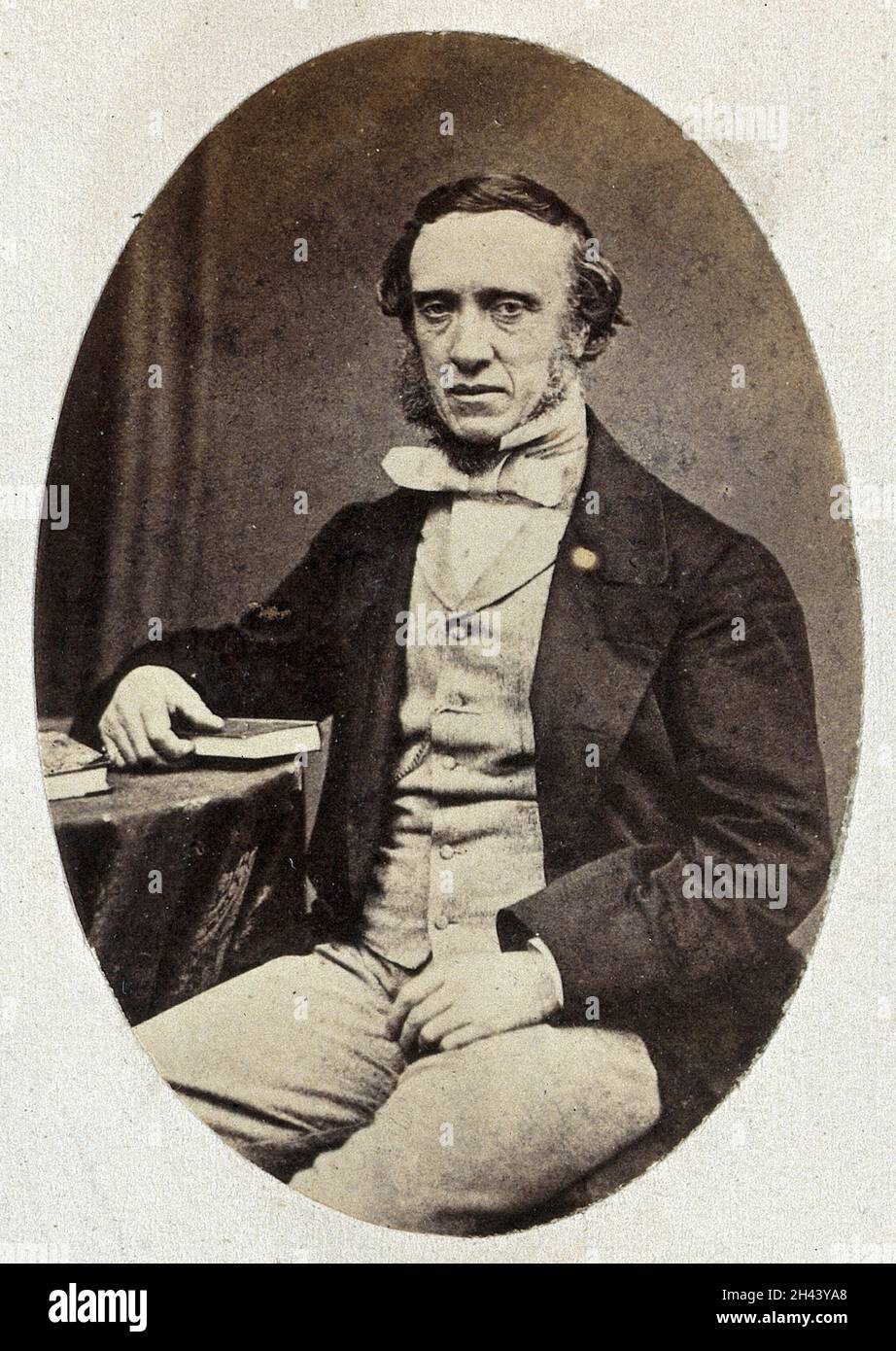 James Spence. Photograph Stock Photo - Alamy