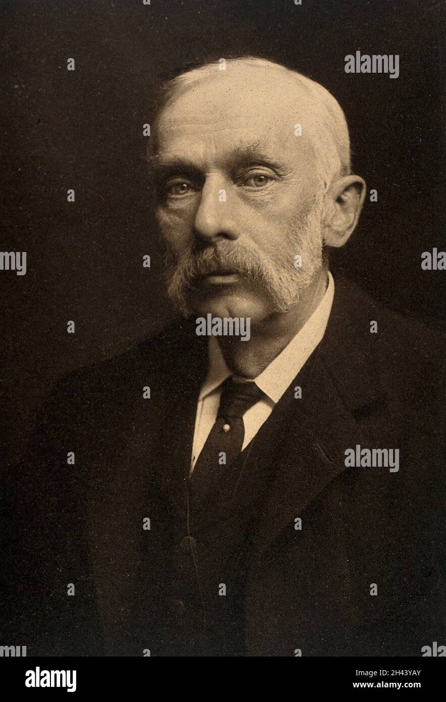 Godlee hi-res stock photography and images - Alamy