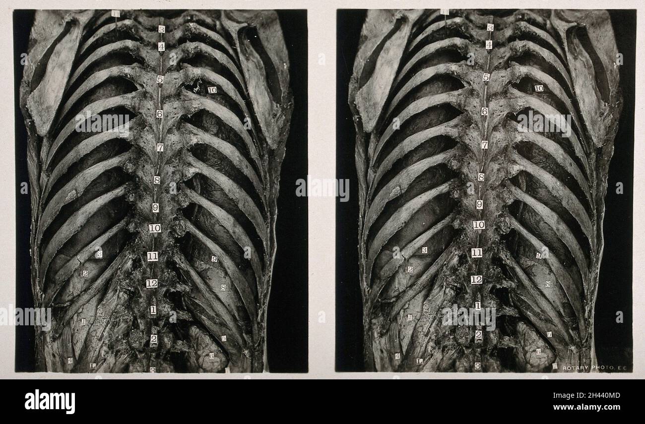 Anatomy dissection hi-res stock photography and images - Alamy