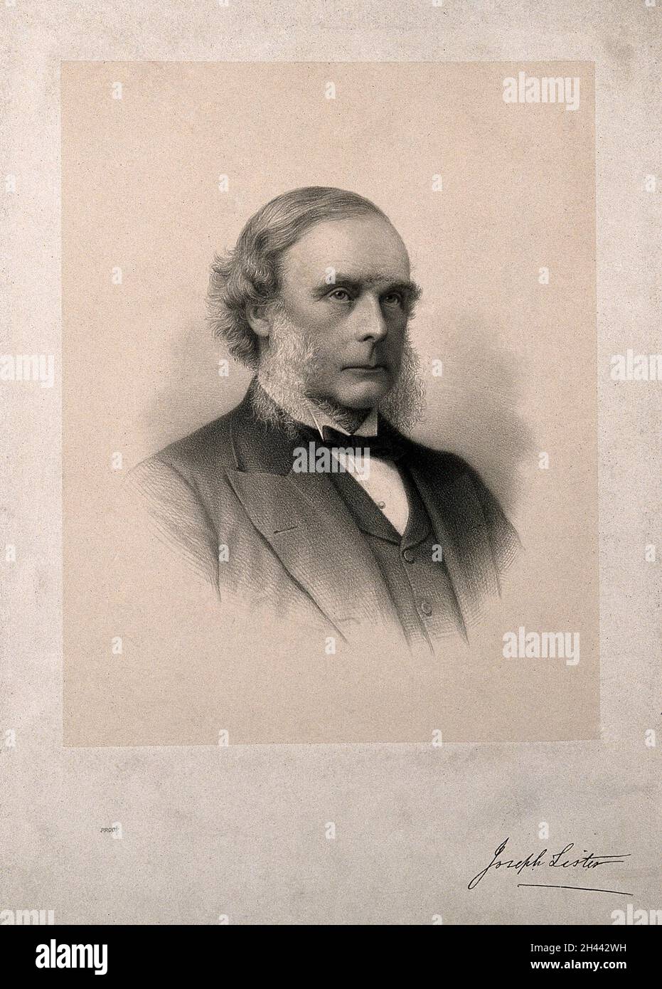 Joseph Lister, 1st Baron Lister. Lithograph Stock Photo - Alamy