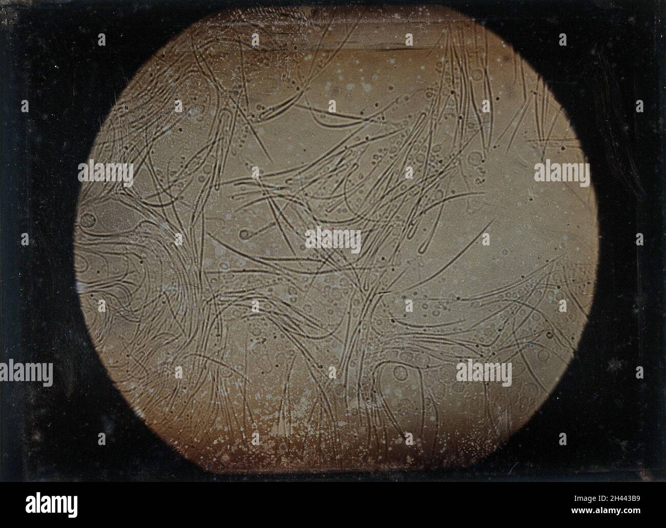 Spermatozoa of a frog. Photomicrograph by Léon Foucault, 1844 Stock ...