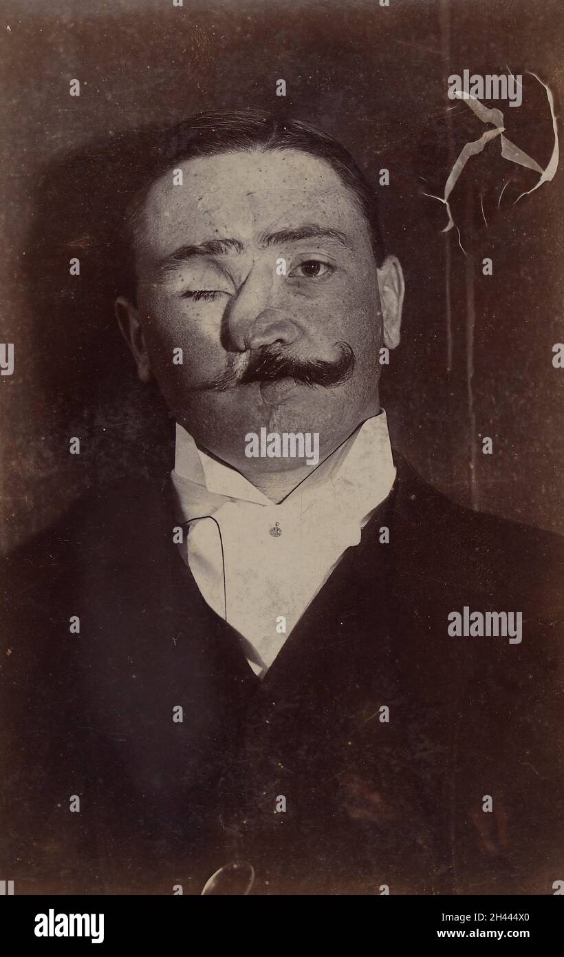 Reconstructed face hi-res stock photography and images - Alamy