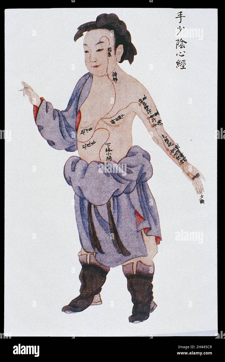 Acupuncture heart hi-res stock photography and images - Alamy