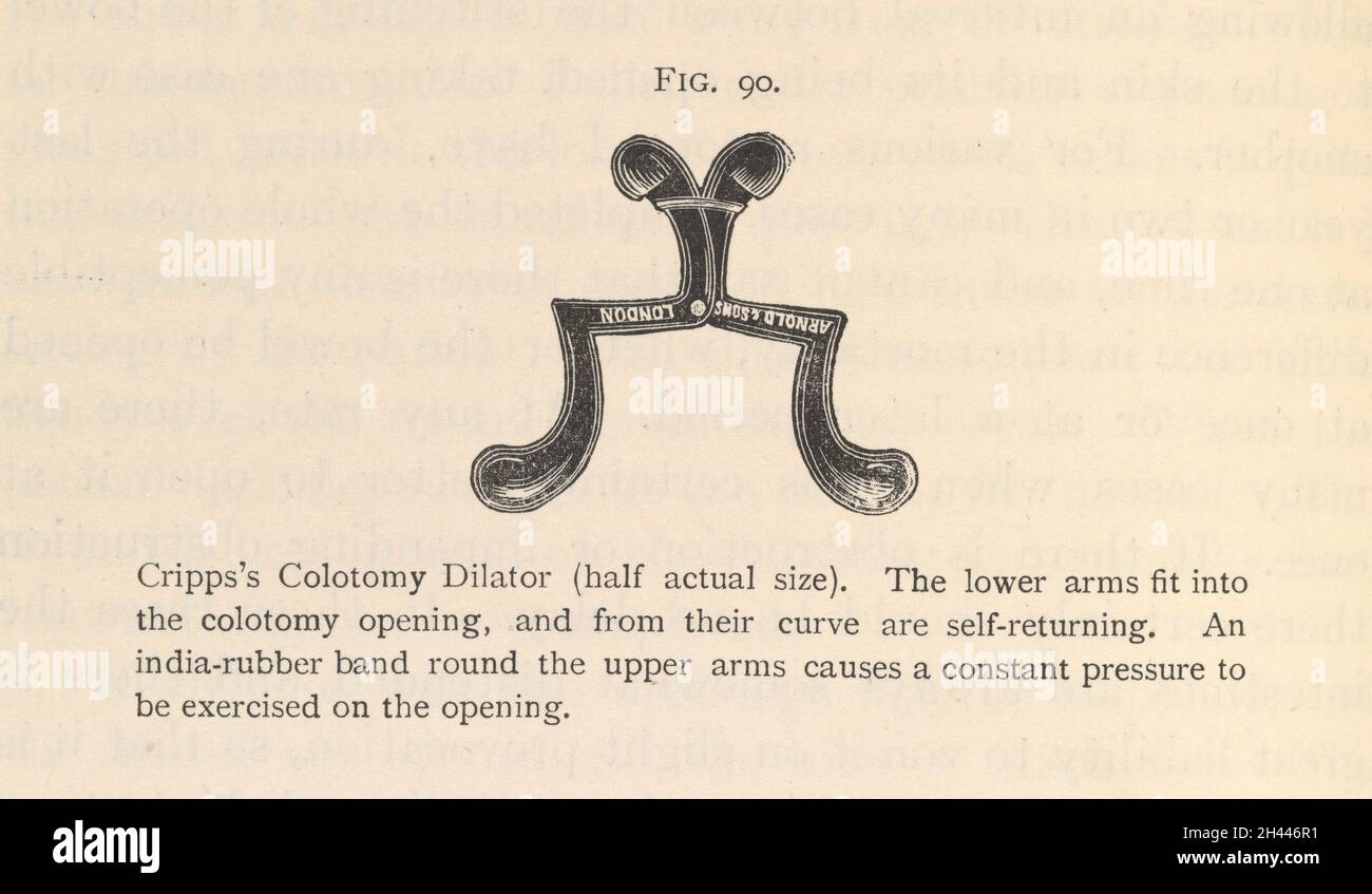 Fig. 90. Cripps Colotomy Dilator Stock Photo - Alamy