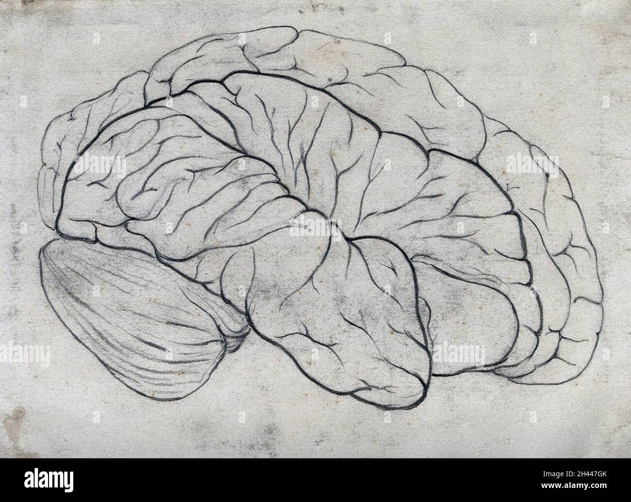Brain with defect in the right frontal region. Pencil drawing Stock ...