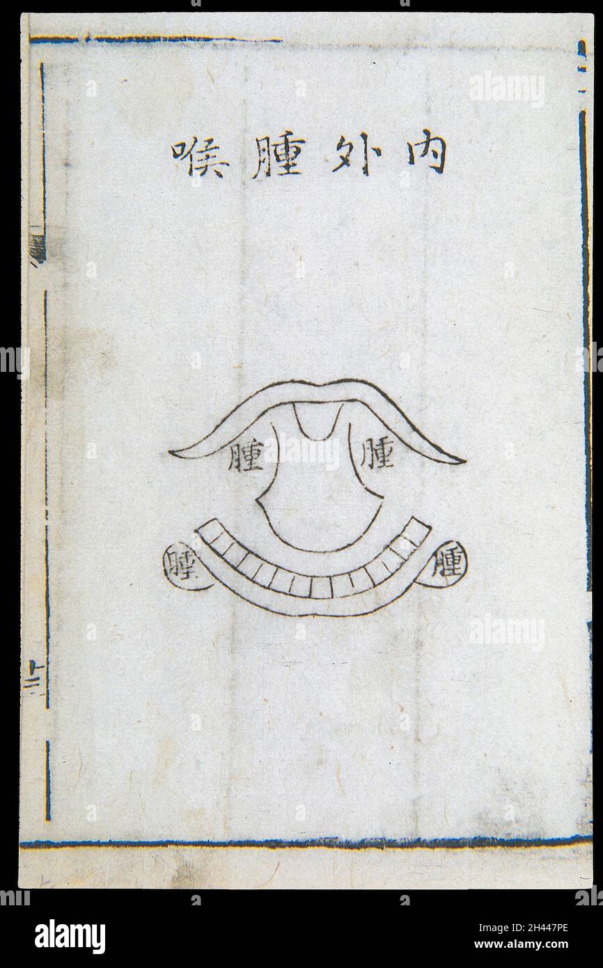 C18 Chinese woodcut: Inflammation of the throat Stock Photo - Alamy