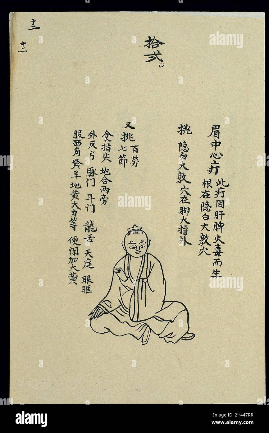 C19 Chinese ink drawing: Boils - boil between the eyebrows Stock Photo ...