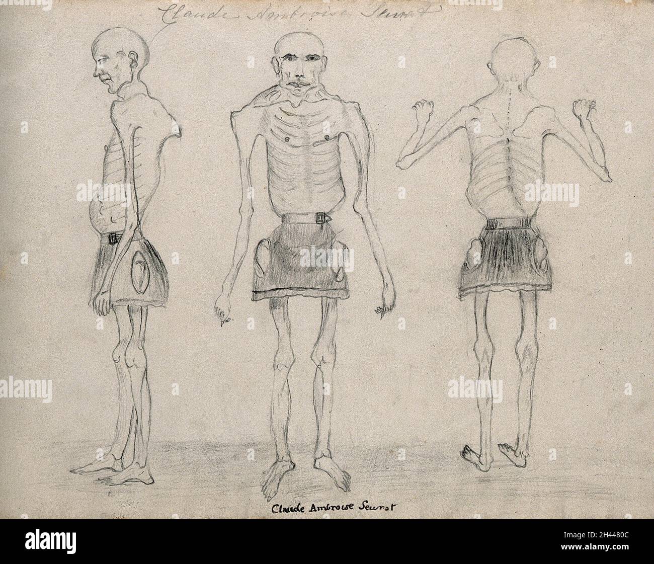 Claude Ambroise Seurat, a very thin man who was known as the 'Human ...