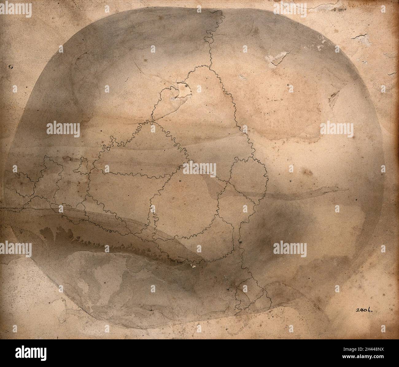 The deformed skull of James Cardinal as viewed from above. Drawing ...
