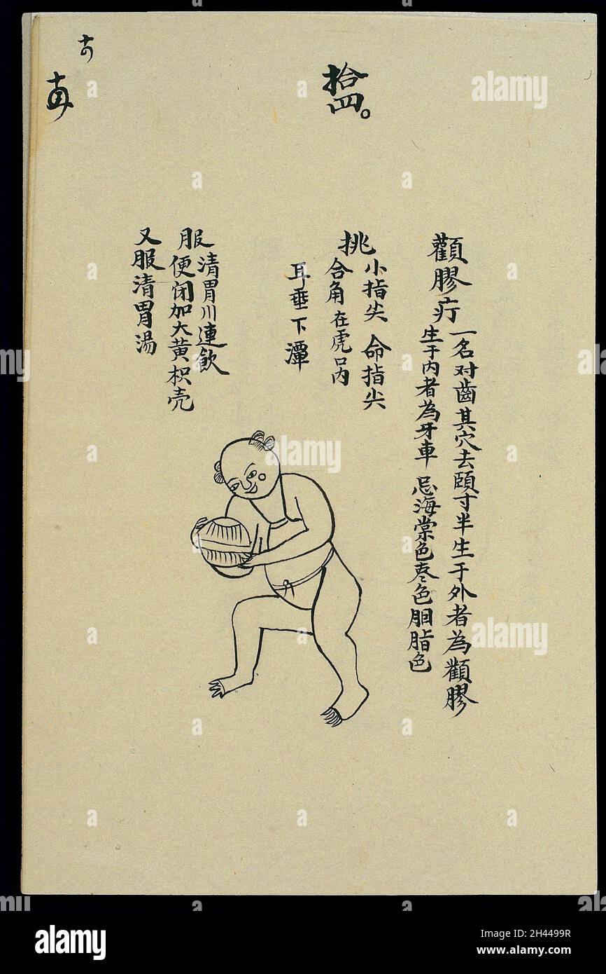 C19 Chinese ink drawing: Boils - boil stuck to the cheekbone Stock ...